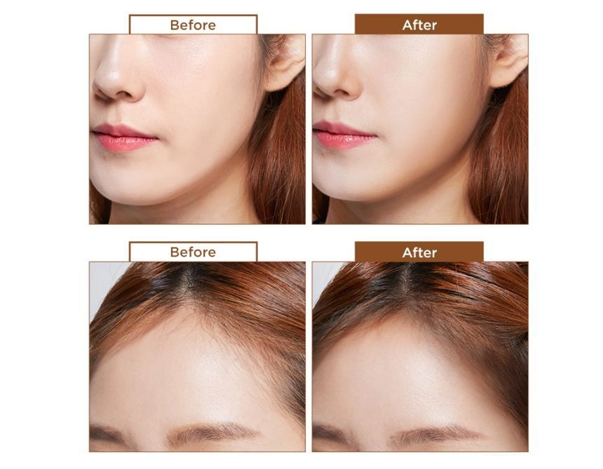 fmgt Dual Contour – Seoul Collection